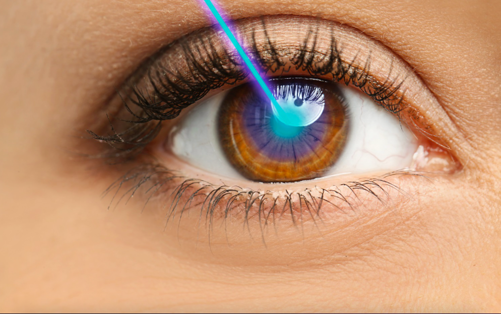 How Do You Know If Lasik Eye Surgery is the Right Option for You?