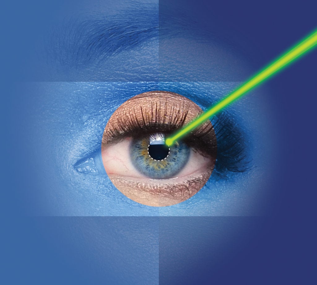 Can You Have A Second Lasik Surgery?