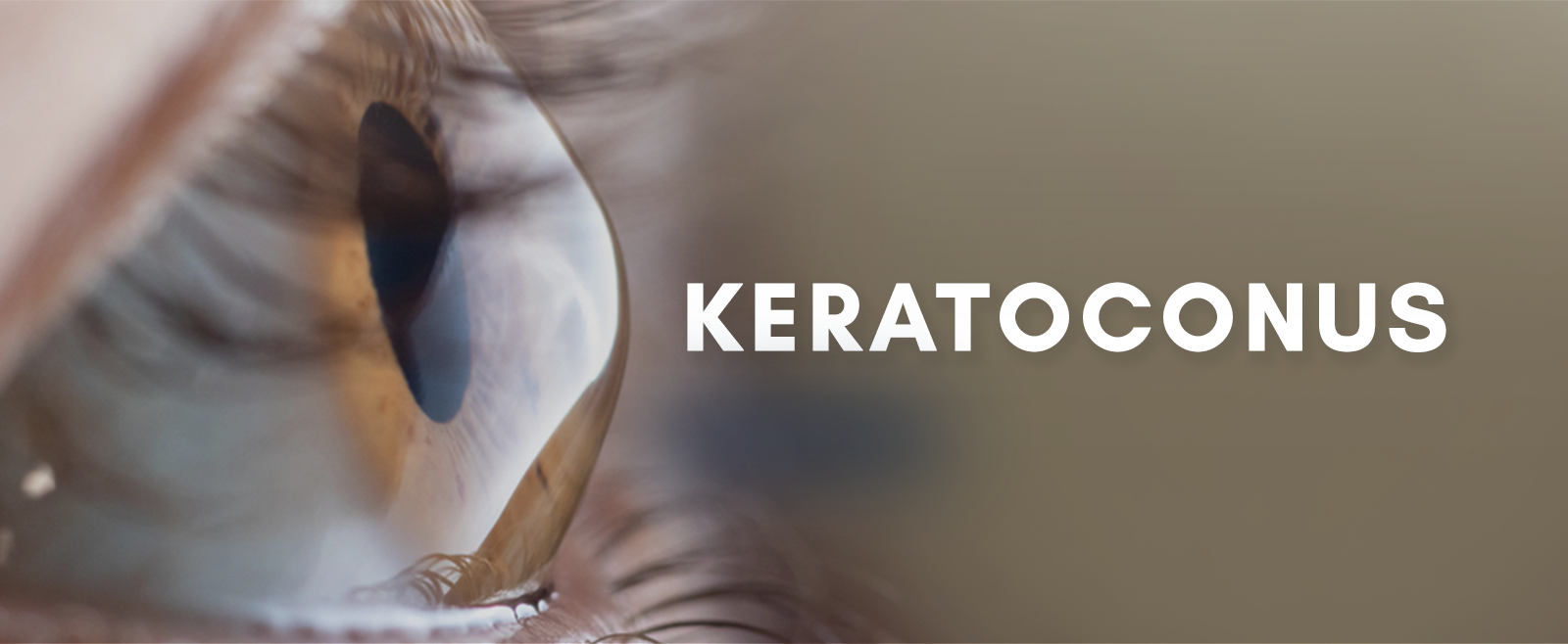 Keratoconus Management - Visual Aids Centre