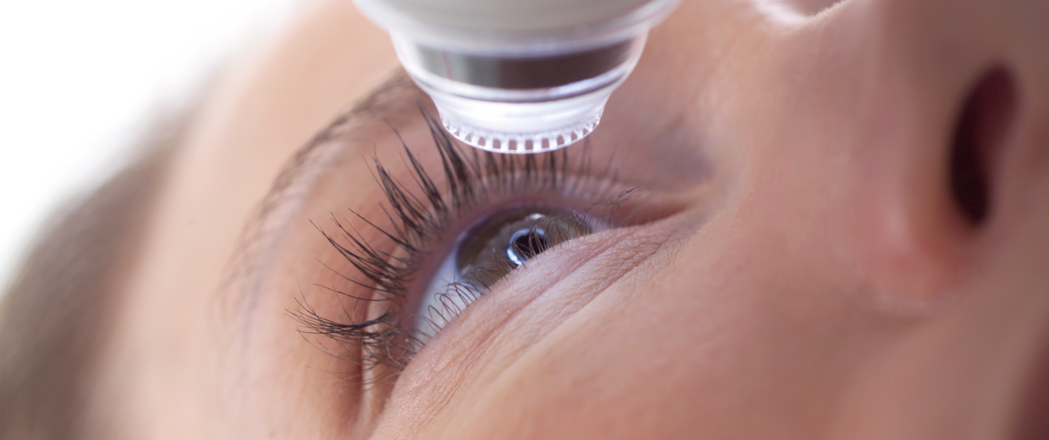 Does Lasik Eye Surgery Hurt? - Visual Aids Centre