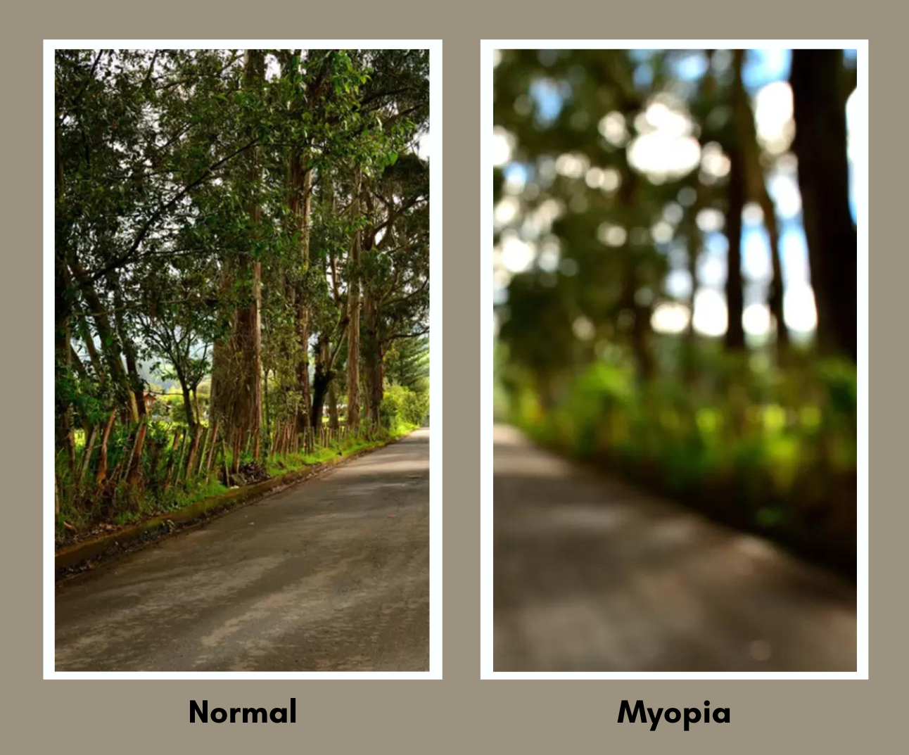 Refractive Errors - Visual Aids Centre - Lasik Eye Surgery In Delhi