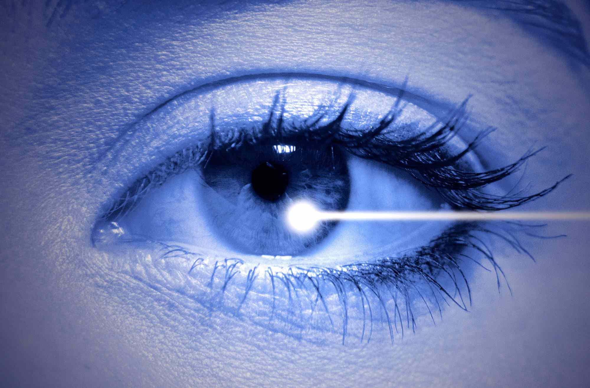 What To Expect After LASIK Eye Surgery? - Visual Aids Centre