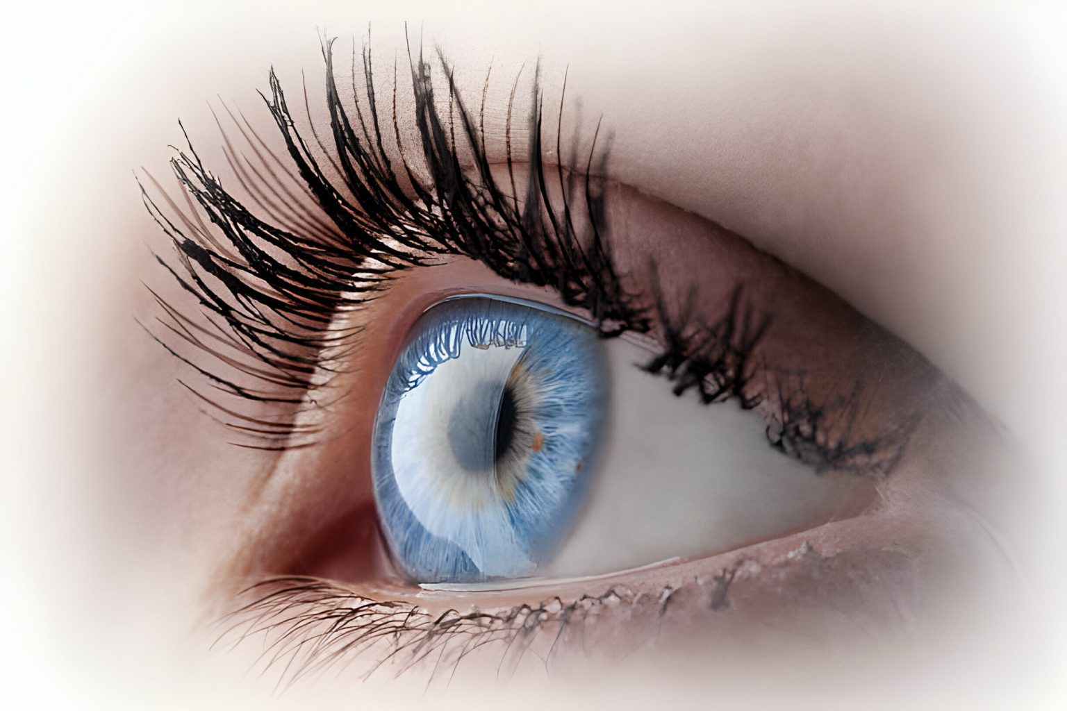 Lasik Surgery in South Delhi - Visual Aids Centre