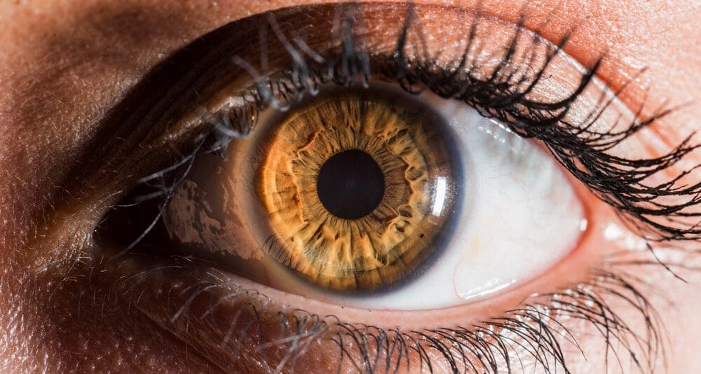 Astigmatism After SMILE Surgery — Causes & Risks
