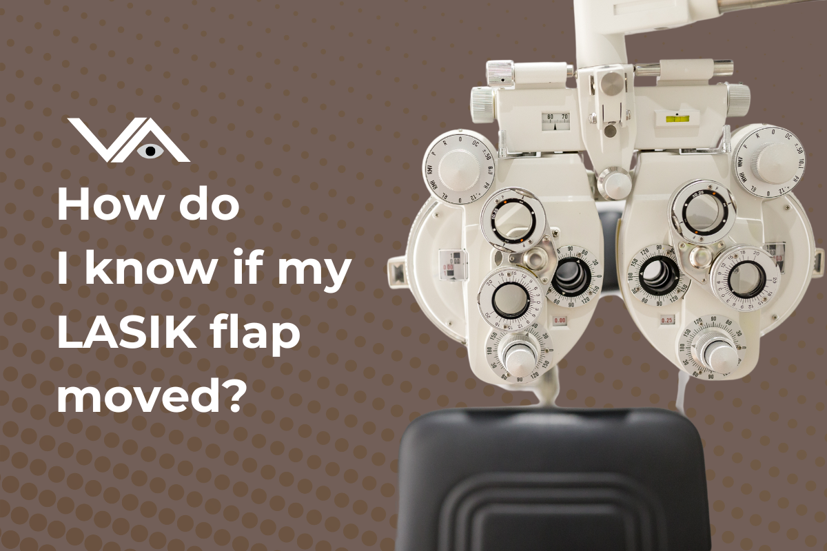 How Do I Know If My Lasik Flap Moved?