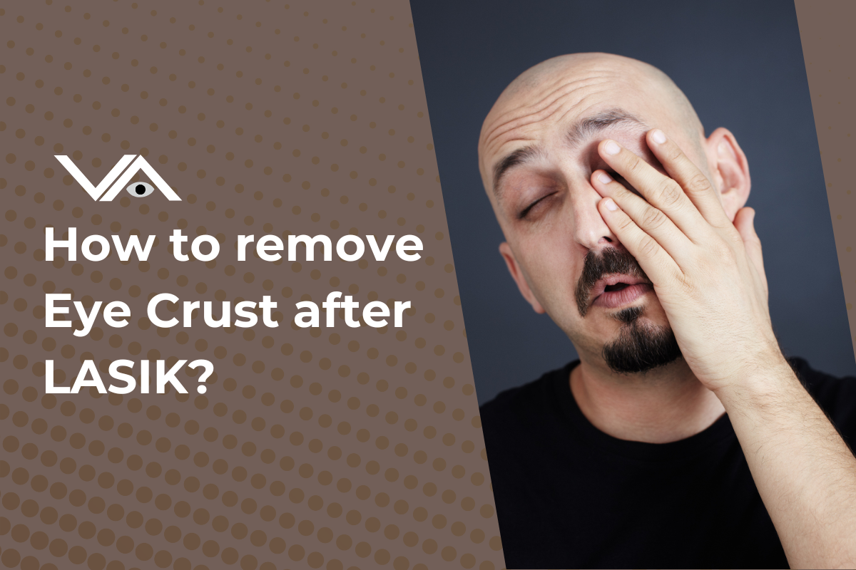 How to Remove Eye Crust After Lasik?