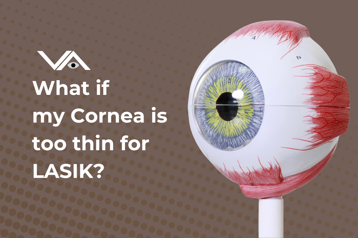 What If My Cornea Is Too Thin for Lasik?