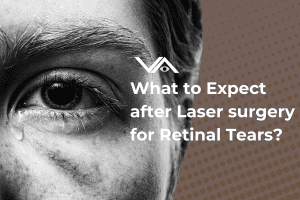 What to Expect After Laser Surgery for Retinal Tears?