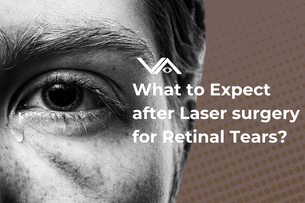 What to Expect After Laser Surgery for Retinal Tears?