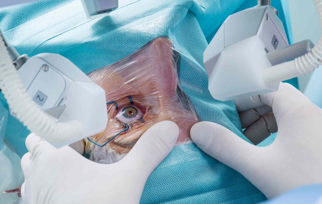 Lasik Flap Complications?