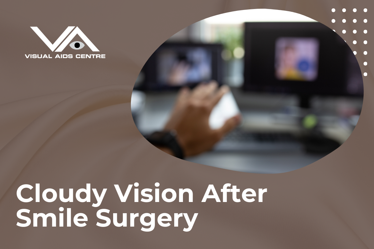 Cloudy Vision After Smile Surgery