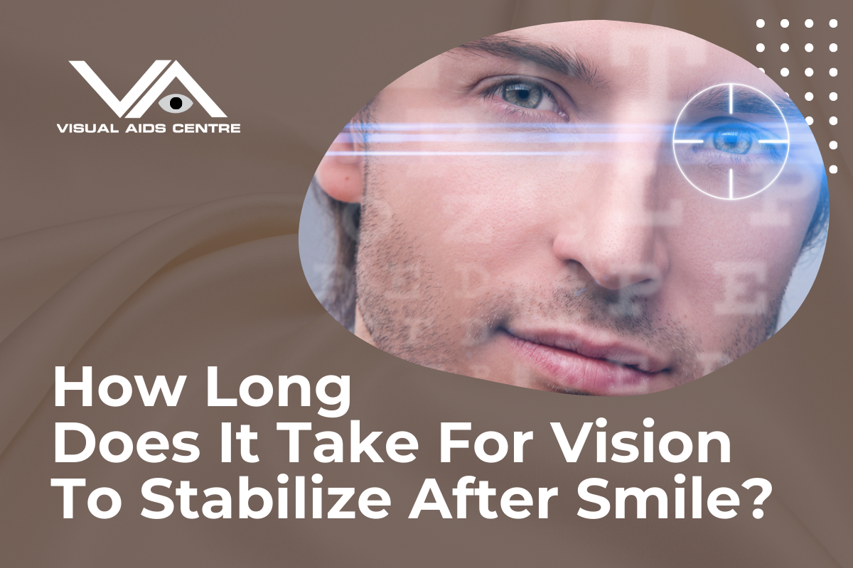 How Long Does It Take for Vision to Stabilize After Smile?