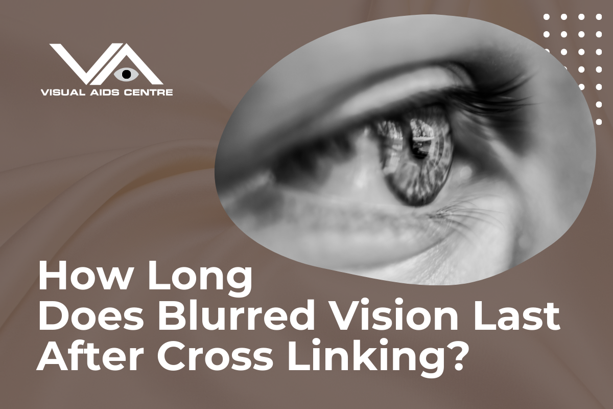 How Long Does Blurred Vision Last After Cross Linking?