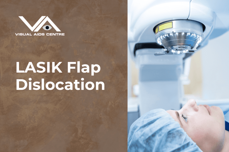 Lasik Flap Dislocation?