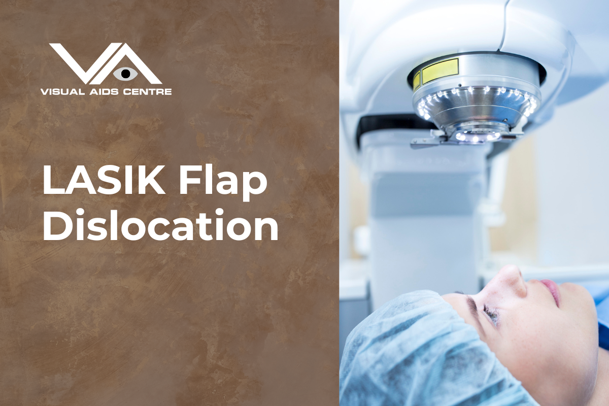 Lasik Flap Dislocation?