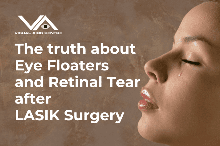 The Truth About Eye Floaters and Retinal Tear After Lasik Surgery