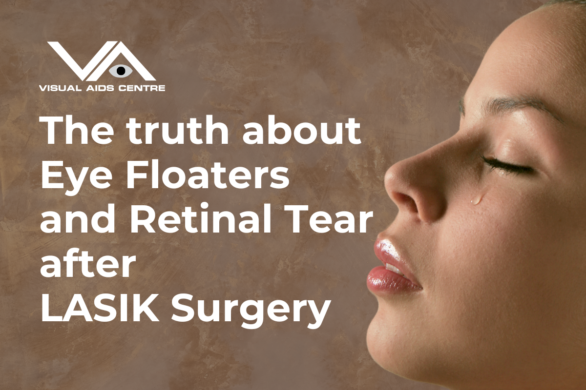 The Truth About Eye Floaters and Retinal Tear After Lasik Surgery
