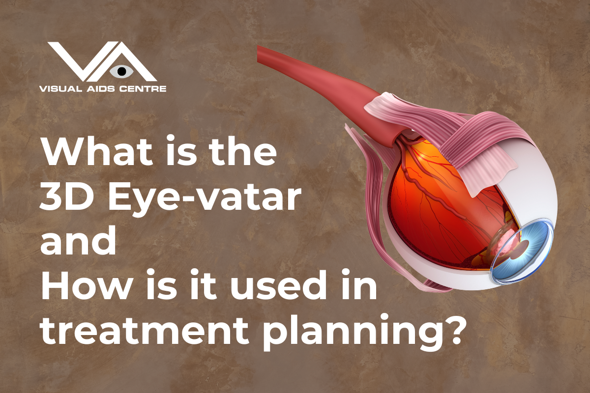 What is the 3D Eye-vatar And How Is It Used In Treatment Planning?