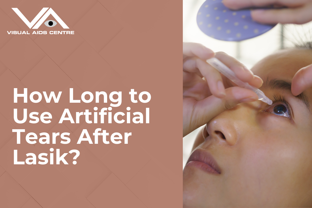 How Long to Use Artificial Tears After Lasik?