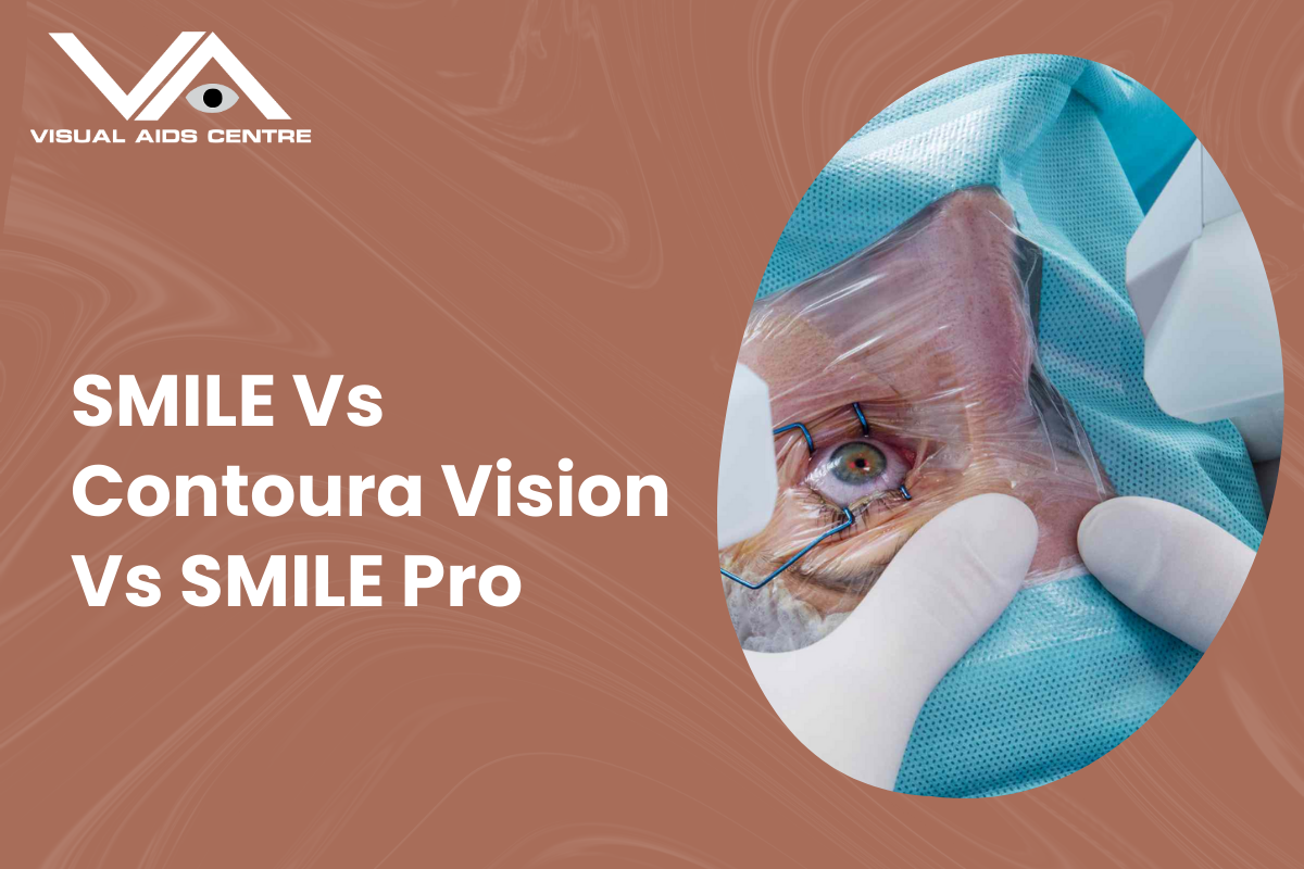 SMILE Vs Contoura Vision Vs SMILE Pro - Which Surgery is Best?