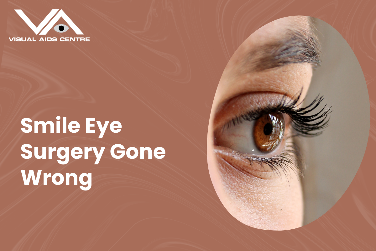 Smile Eye Surgery Gone Wrong