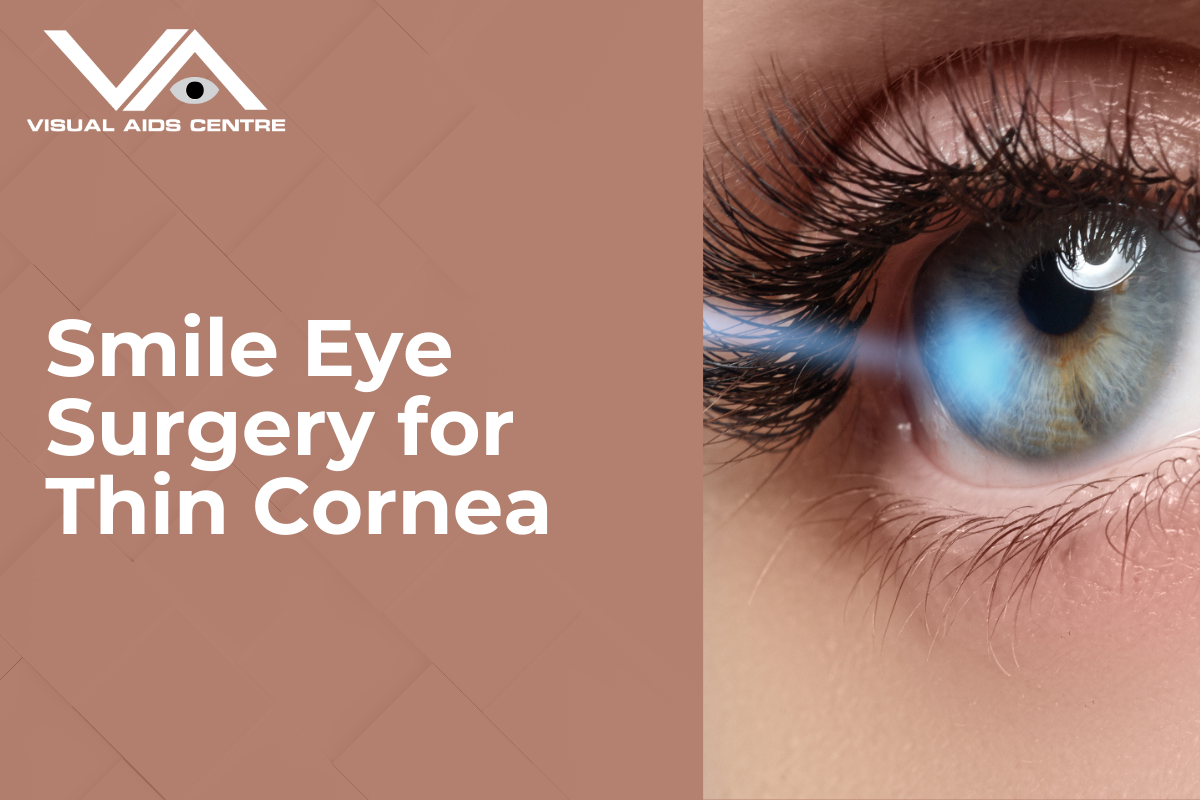 Smile Eye Surgery for Thin Cornea