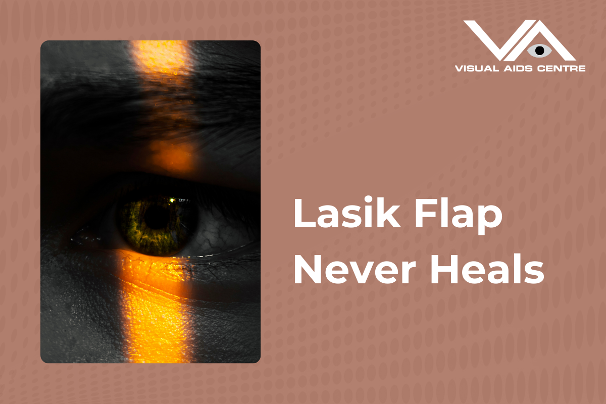 Lasik Flap Never Heals?
