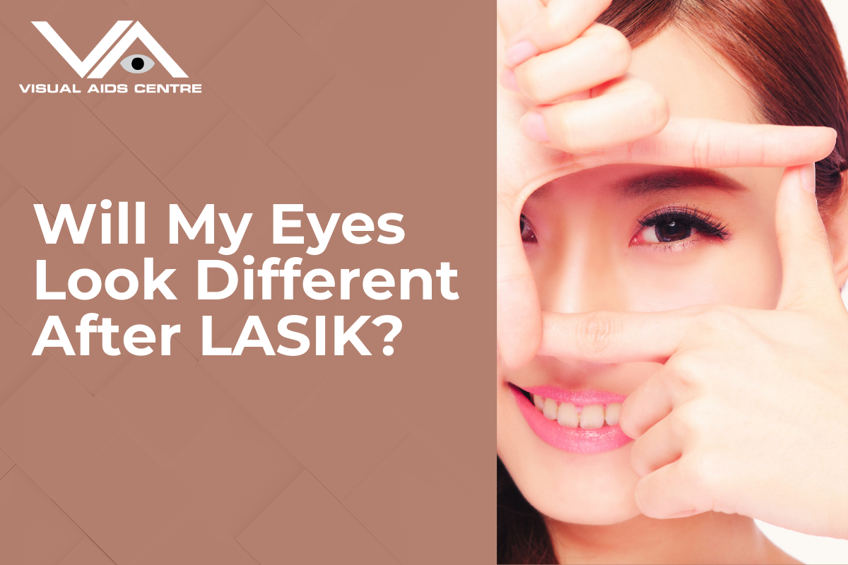 Will My Eyes Look Different After LASIK? - Visual Aids Centre