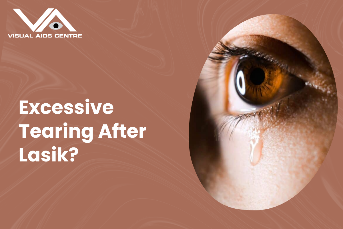 Excessive Tearing After Lasik?