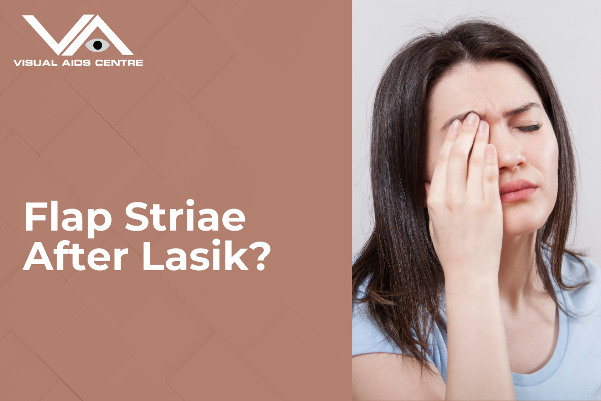 Flap Striae After Lasik?
