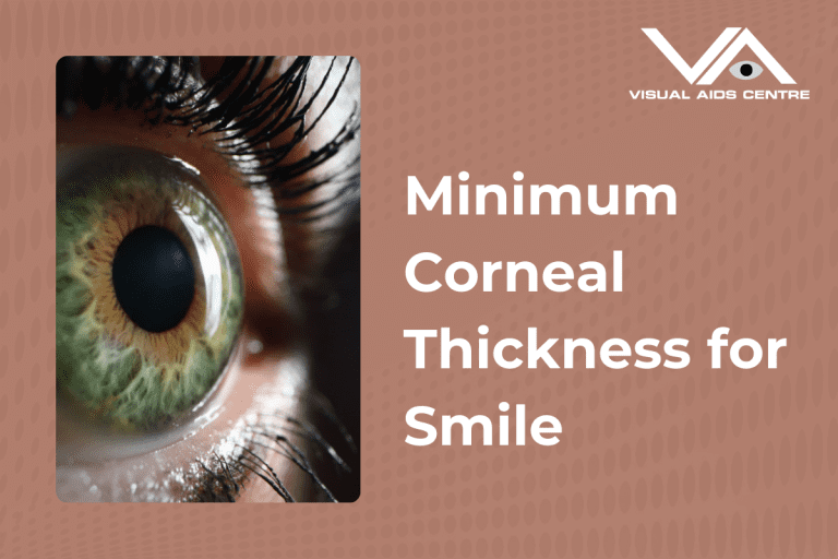 Minimum Corneal Thickness for Smile