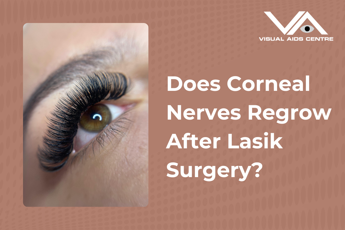 Does Corneal Nerves Regrow After Lasik Surgery? - Visual Aids Centre