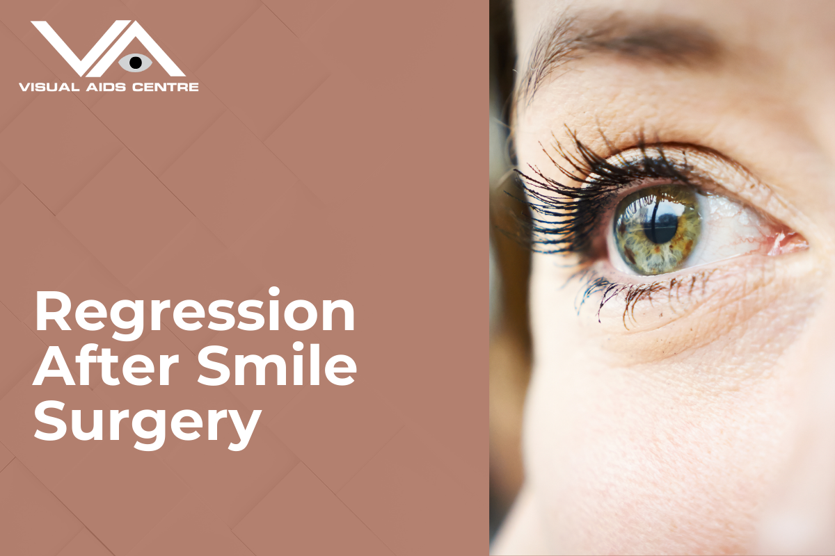 Regression After Smile Surgery