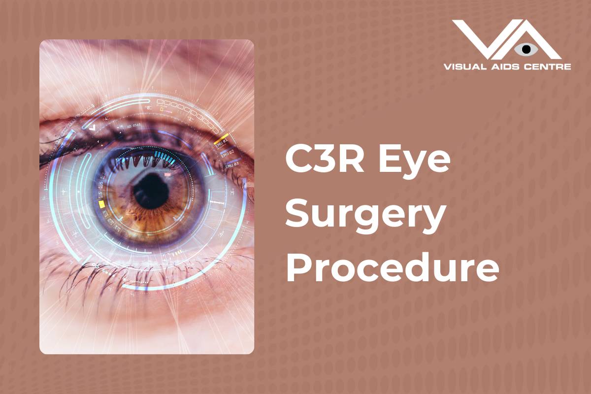C3r Eye Surgery Procedure - Visual Aids Centre