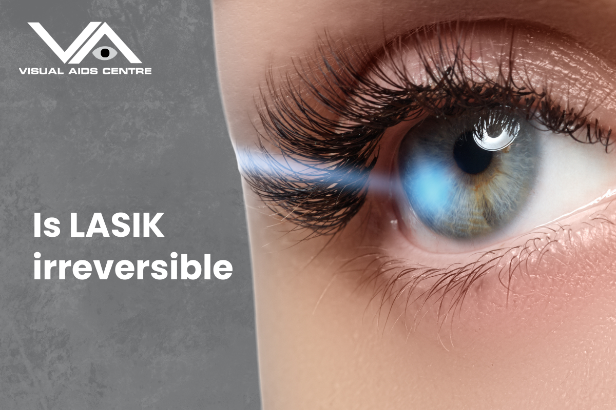Is Lasik Irreversible