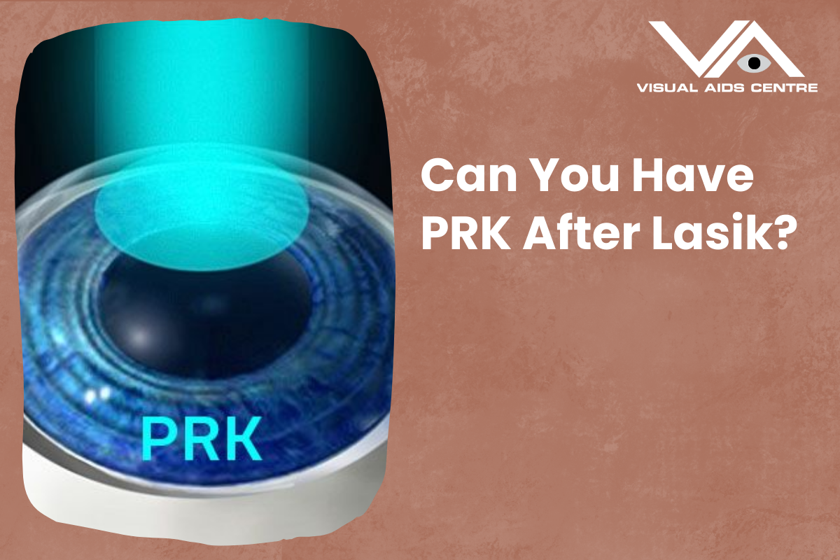 Can You Have Prk After Lasik?