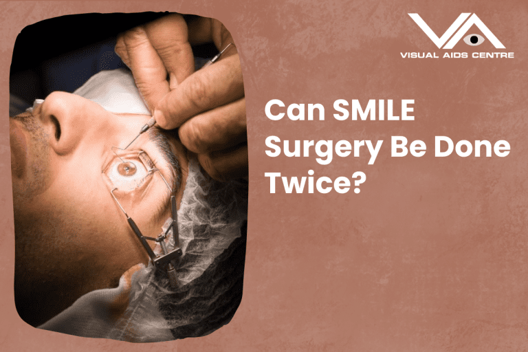 Can SMILE Surgery Be Done Twice? - Visual Aids Centre