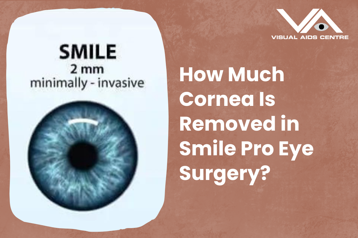 How Much Cornea Is Removed in Smile Pro Eye Surgery?