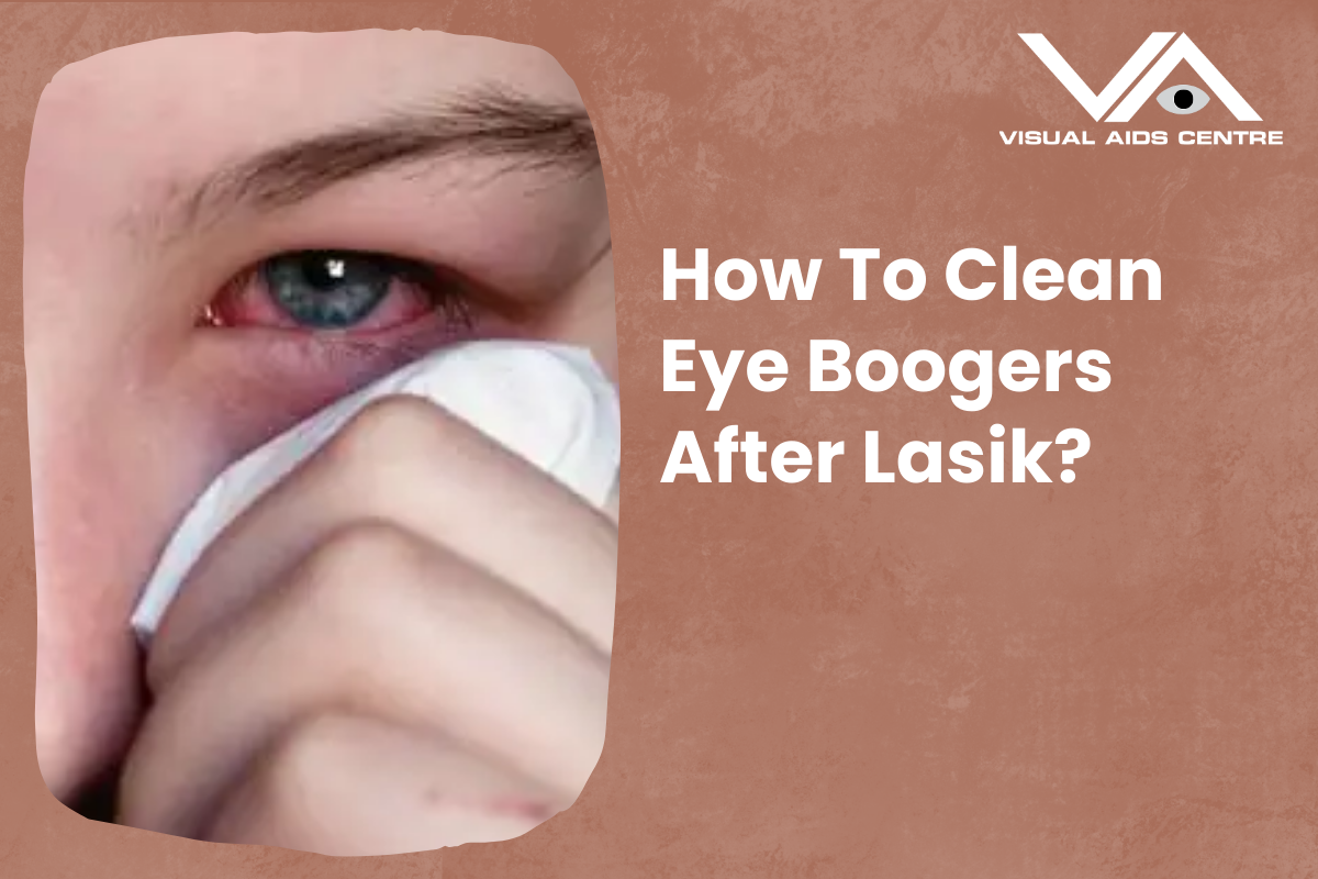 How To Clean Eye Boogers After Lasik?
