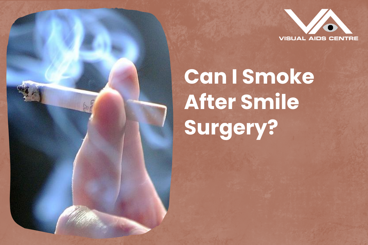 Can I Smoke After Smile Surgery? - Visual Aids Centre