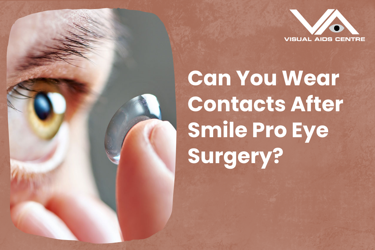 Can You Wear Contacts After Smile Pro Eye Surgery?
