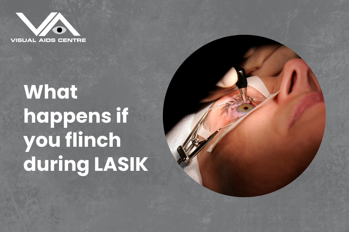 What Happens If You Flinch During Lasik?