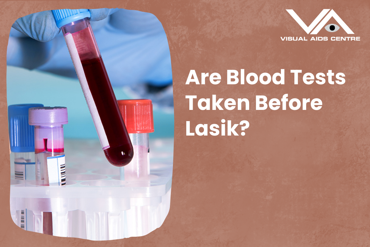 Are Blood Tests Taken Before Lasik?