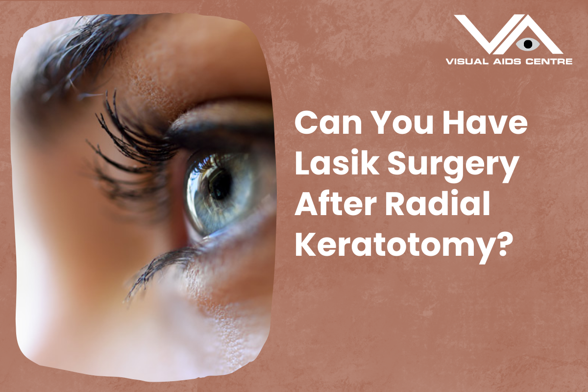 Can You Have Lasik Surgery After Radial Keratotomy?