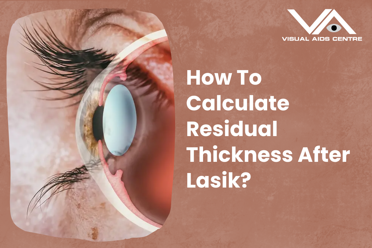 How To Calculate Residual Thickness After Lasik? How To Calculate Residual Thickness After Lasik?