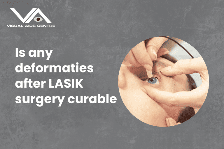Is Any Deformaties After Lasik Surgery Curable?