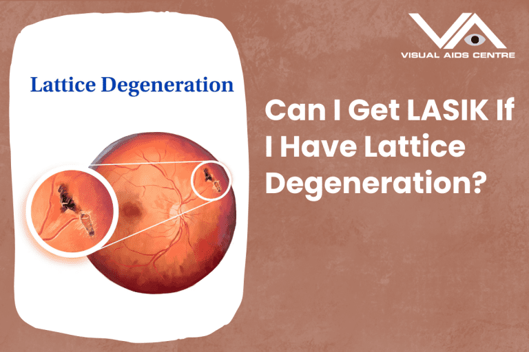 Can I Get LASIK If I Have Lattice Degeneration?