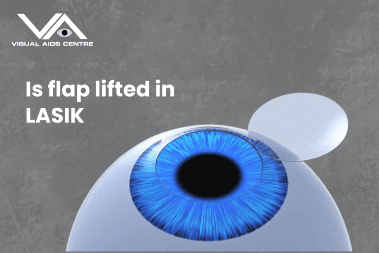 Is Flap Lifted In Lasik?