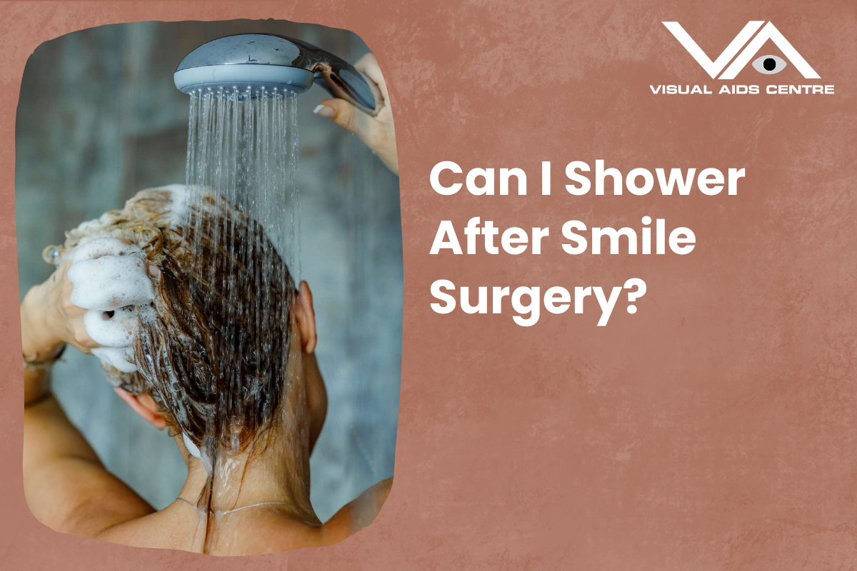 Can I Shower After Smile Surgery? - Visual Aids Centre