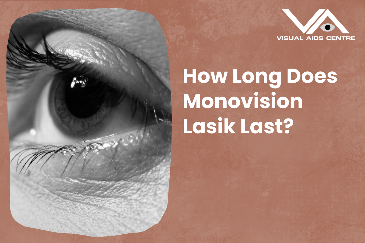 How Long Does Monovision Lasik Last?